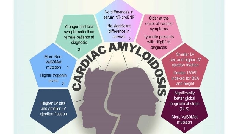 Key warning signs of cardiac amyloidosis you should know